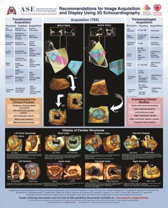 Image Acquisition and Display Using 3D Echo Poster