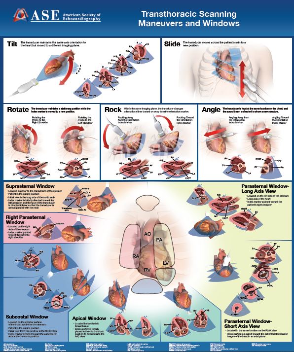 Comprehensive TTE Scanning Maneuvers and Protocols Poster Set