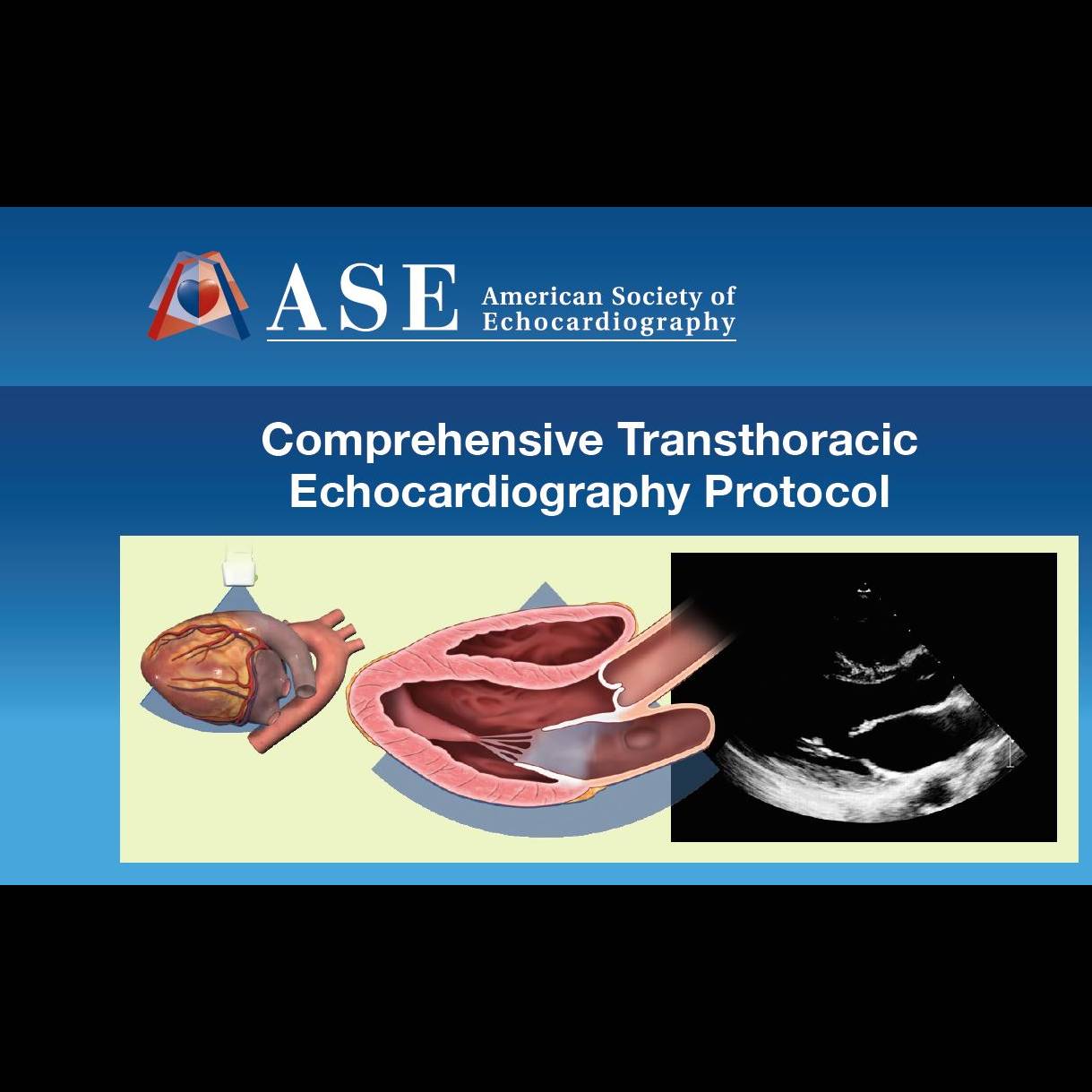 Comprehensive TTE Scanning Maneuvers and TTE Protocol Pocket Guide Set